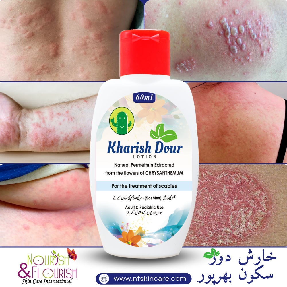 Kharish Dour (Scabies Lotion) Head Louse Lotion – Nourish & Flourish ...